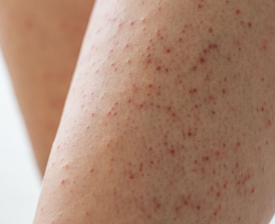 Get your skin in the game