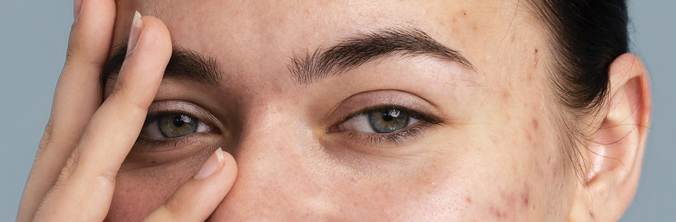 High cholesterol can show up on the skin - Happiest Health