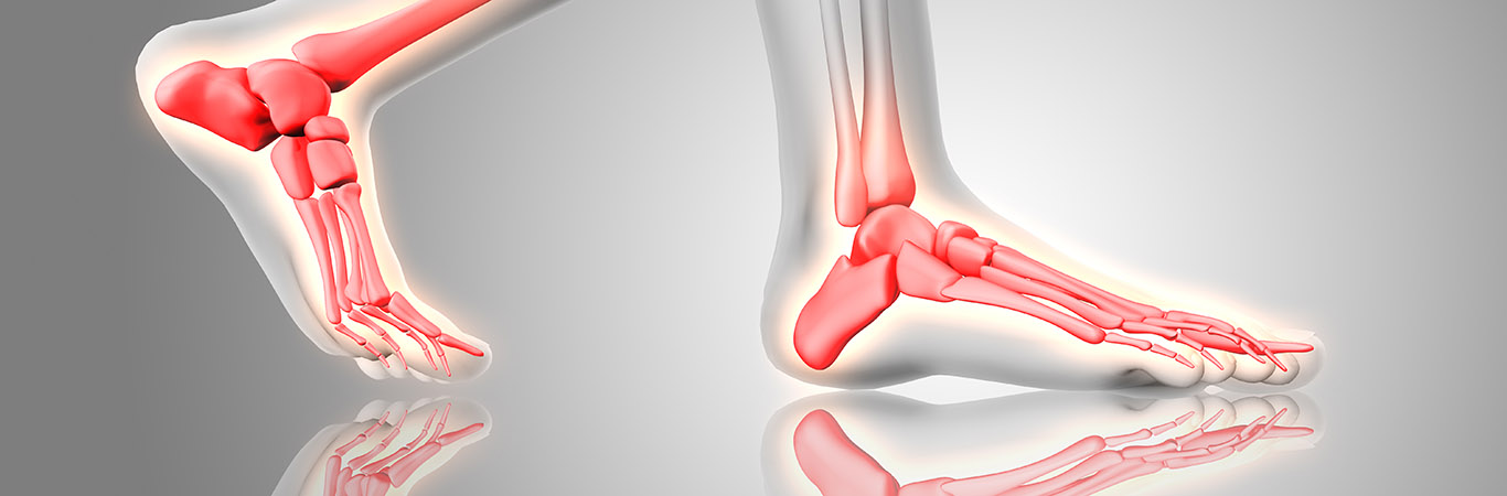 Gangrene in the elderly - Happiest Health