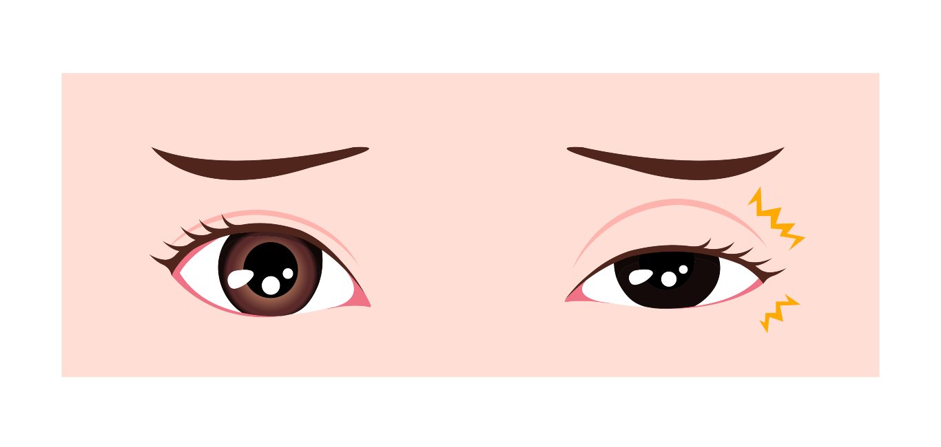 Eye twitch: what is it and ways to manage it | Happiest Health