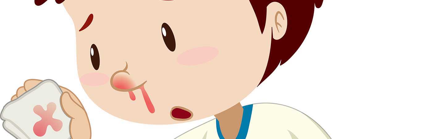 Nosebleeds among children: dos and don’ts - Happiest Health