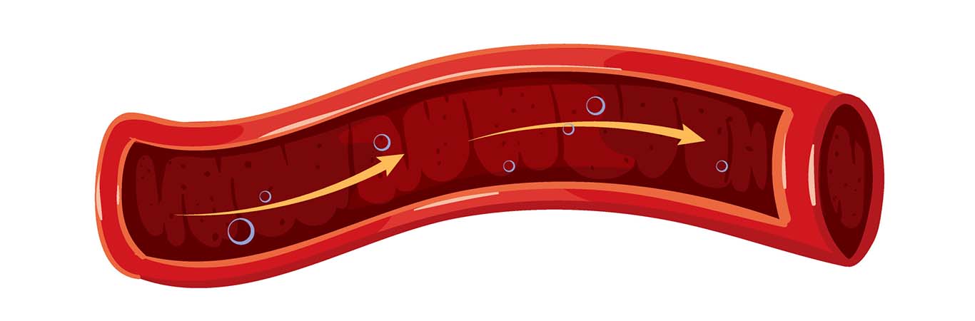 Five natural blood thinners for the heart - Happiest Health